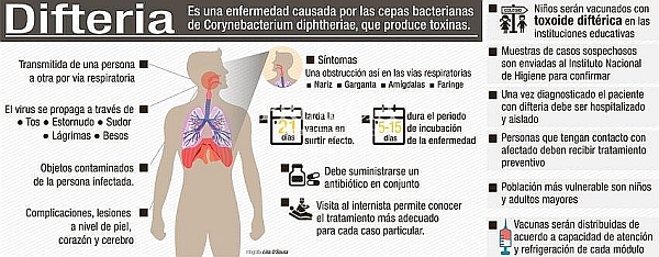¿Qué es la difteria? – Tecnología Hecha Palabra